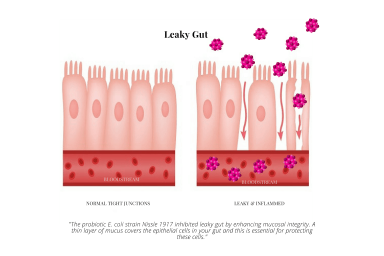 The E-coli Strain 'Nissle 1917' (Mutaflor) A Powerful Probiotic