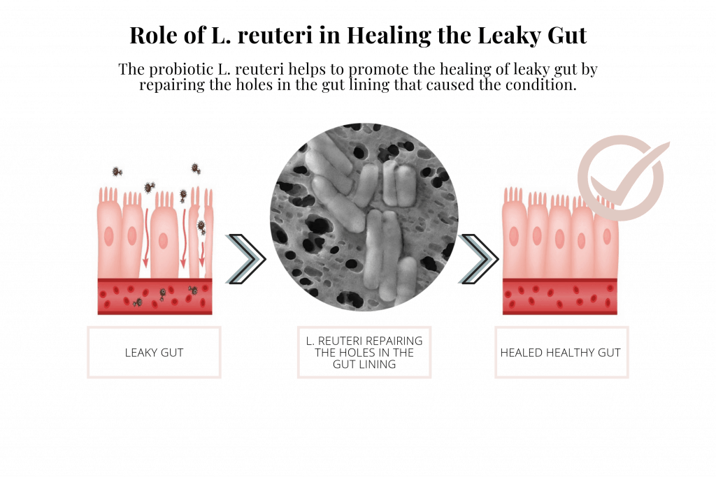 The Vital Role Lactobacillus Reuteri Plays In Your (and Your Babies ...