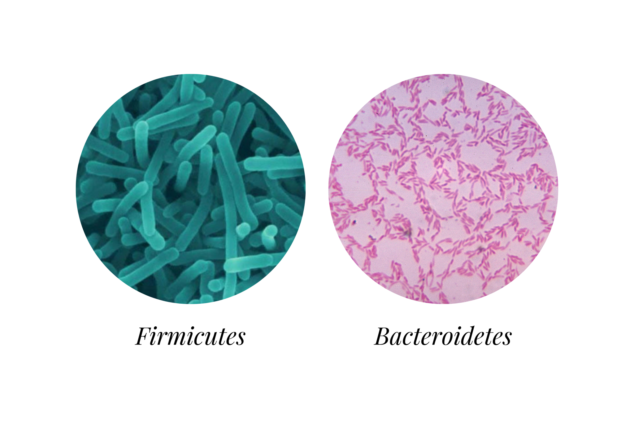 Gut Bacteria And Weight: Everything You Need To Know | Prana Thrive