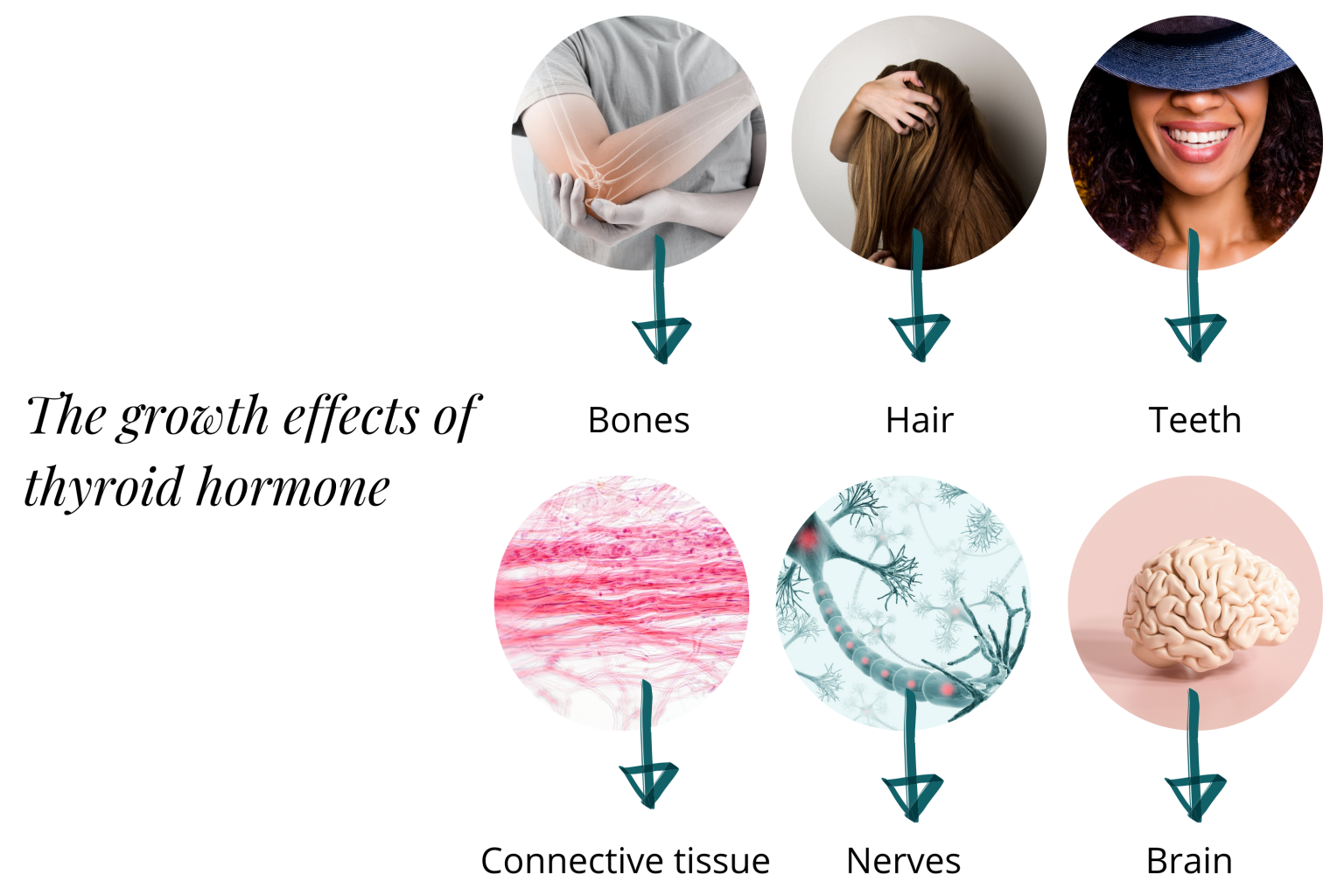 Gut-Thyroid Connection: How Your Gut Bacteria Influence Thyroid Health ...